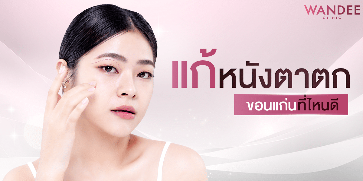 แก้หนังตาตก ขอนแก่น ต้องเลือกคลินิกแบบไหน?